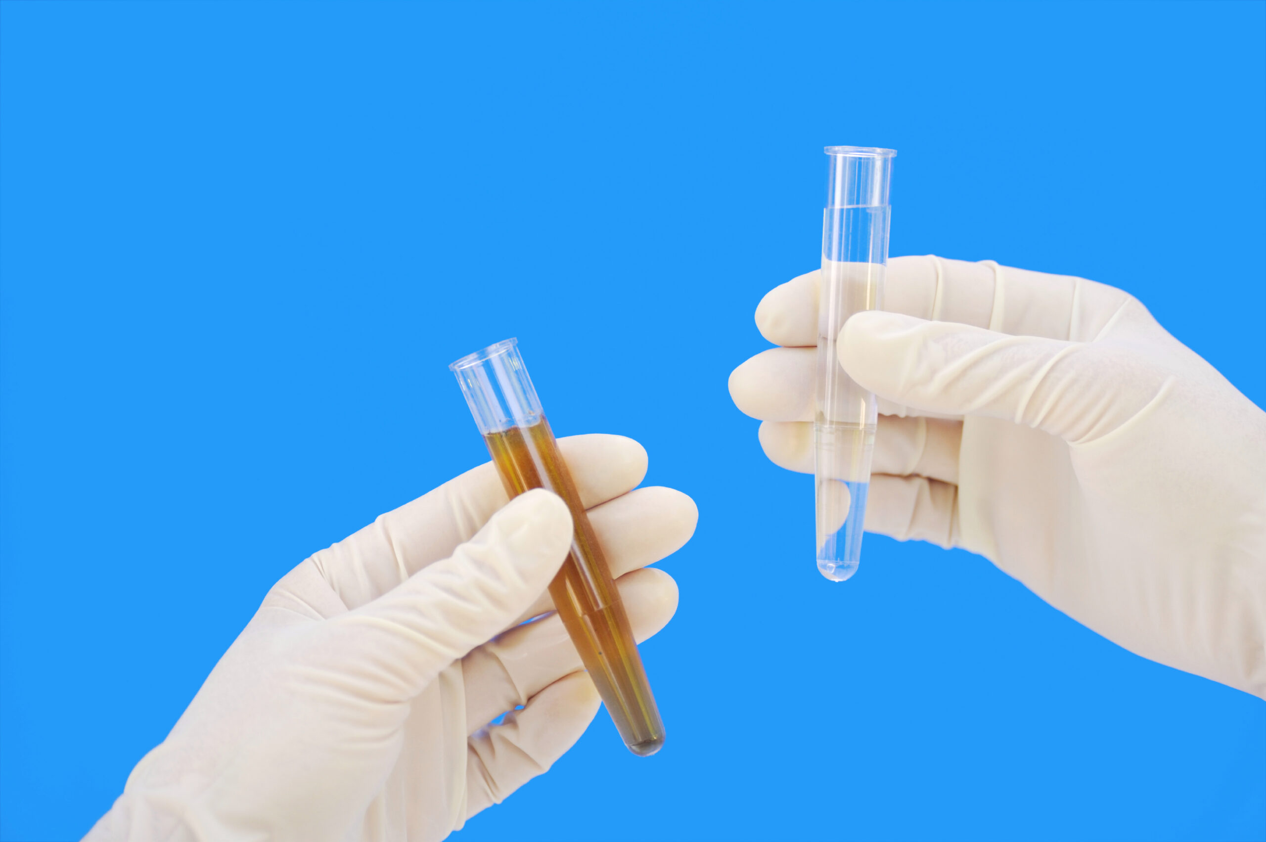 Total Dissolved Solids In Water | Culligan of DFW Area
